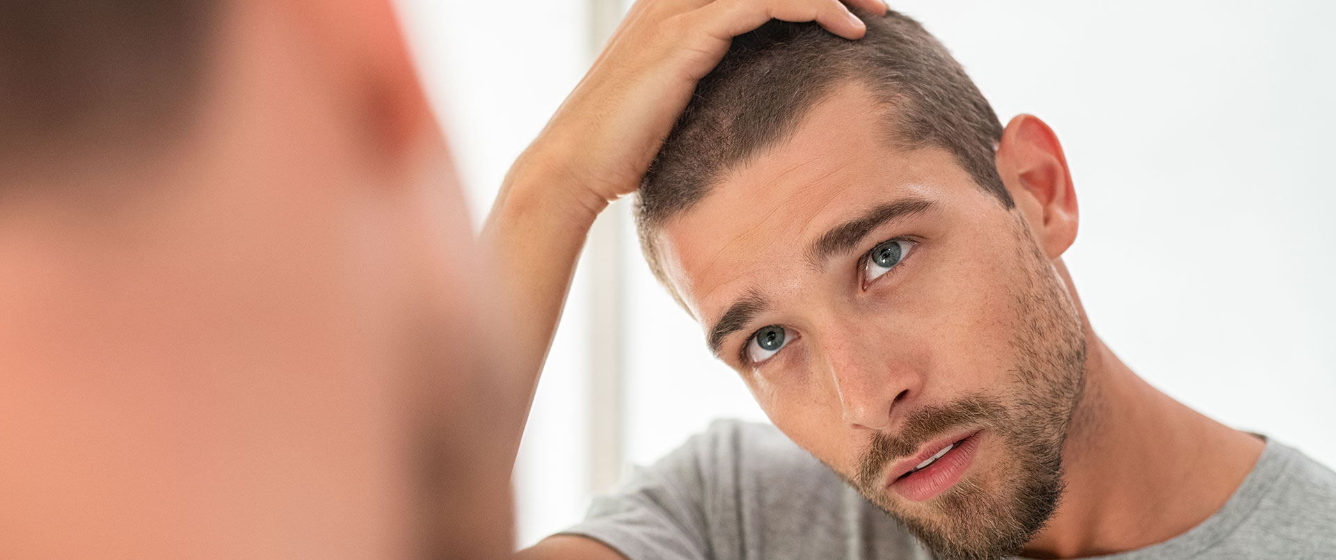 SinOcap – Injerto capilar